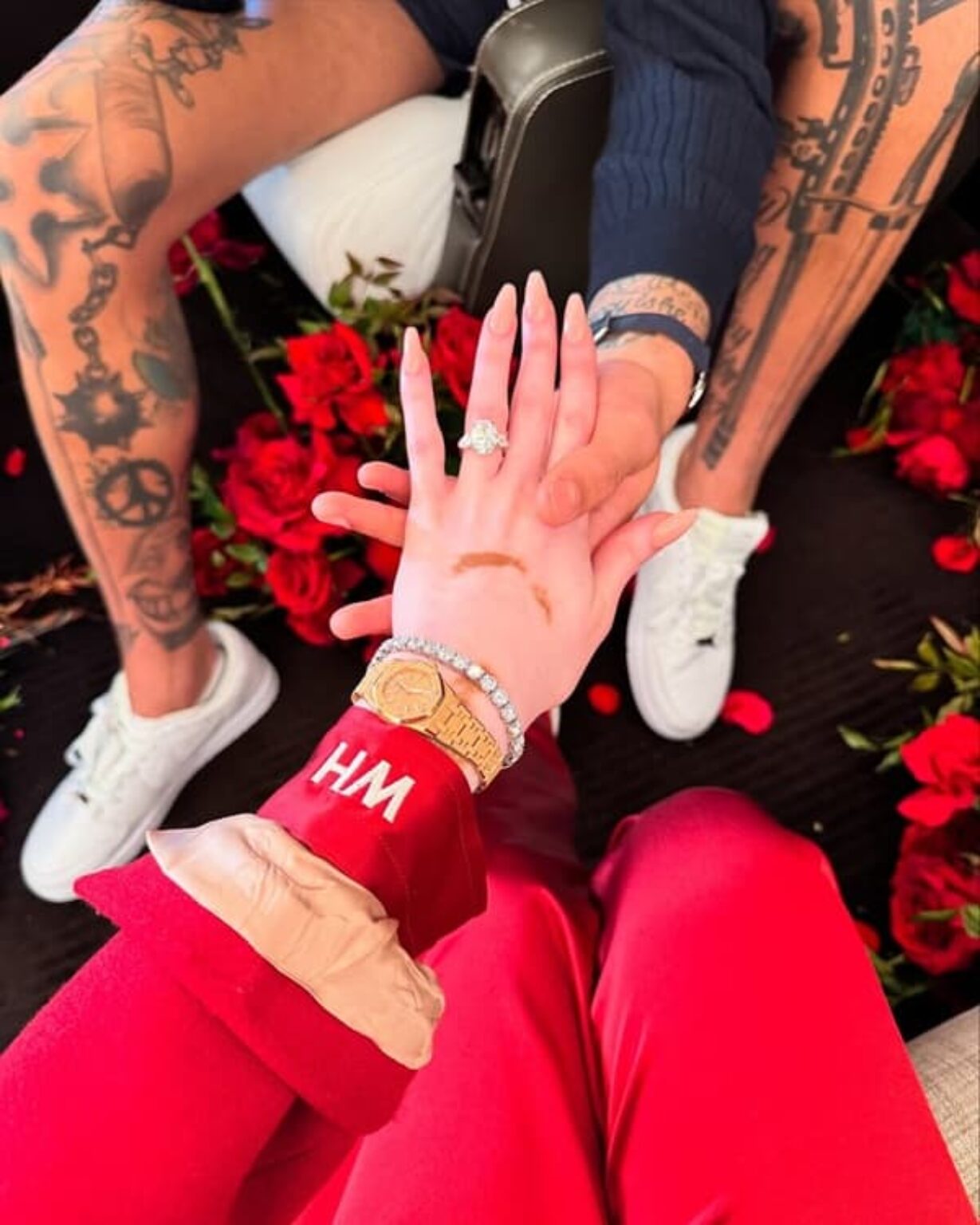 Model Winnie Harlow Is Engaged to Her Boyfriend Kyle Kuzma: See Her ...